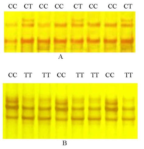 Band Patterns For The Two SNPs A Genotypes Of SNP1 B Genotypes Of Download Scientific