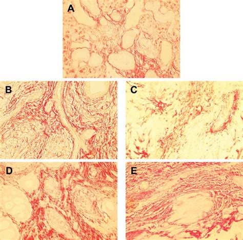 Representative Picrosirius Red Staining Of Different Salivary Gland Download Scientific Diagram