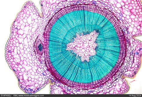 Stock Image Photomicrograph Of A Conifer Stem Showing Secondary Woody Growth Transverse Section