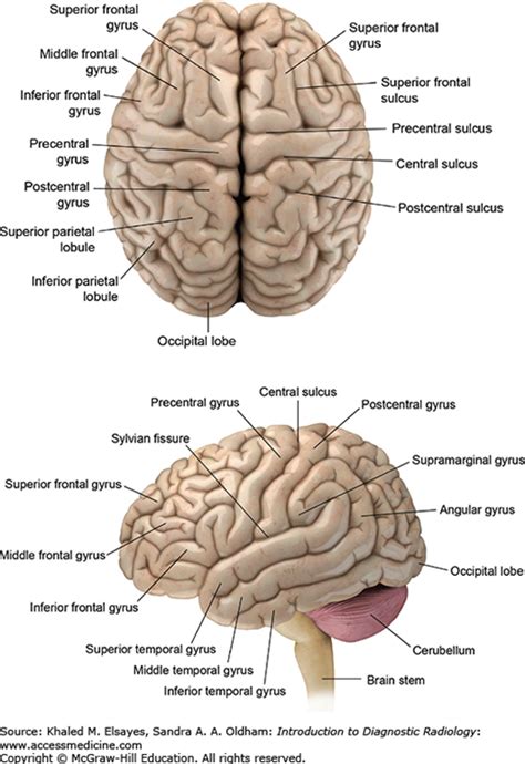 Diagnostic Neuroradiology Radiology Key