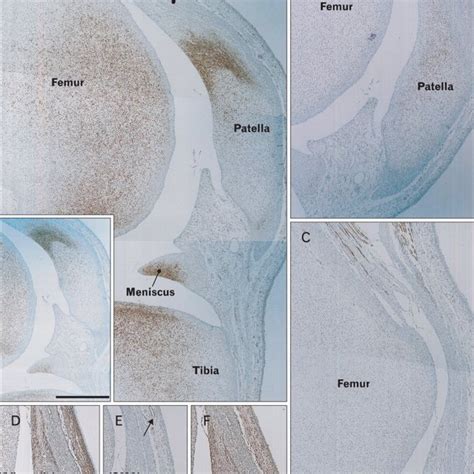 Expression Of Carbonic Anhydrase Type Ix Ca9 And Intermediate Download Scientific Diagram