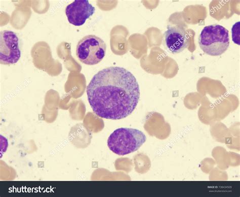 Myelocyte