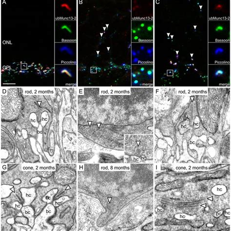 Photoreceptor Ribbon Synapse Integrity In Cacna1f Mutant Mice A C Download Scientific Diagram