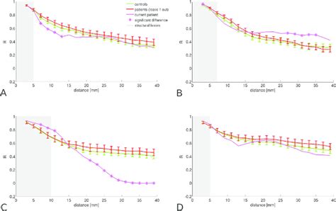 Different Profiles Of Aberrant Connectivity In Patient 2 Transient Download Scientific