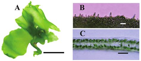Ulva Rigida A Habit B Margin With Small Teeth C Transverse
