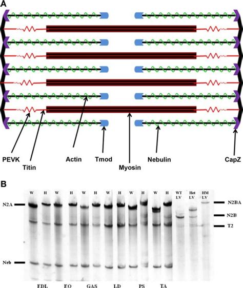 Sarcomere Labeled Actin