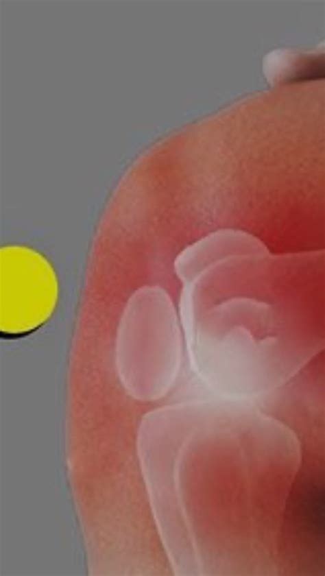 Бауыржан Камалиев ПРИ БОЛЯХ В КОЛЕННОМ СУСТАВЕ ВЫПОЛНЯЙТЕ В ТЕЧЕНИИ ДЕСЯТИ ДНЕЙ ЭТИ УПРАЖНЕНИЯ