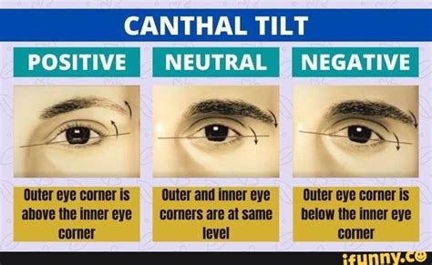 Canthal Tilt Positive Neutral I I Negative I Outer Eye Corner Is Outer