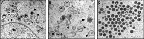Electron Microscopic Examination Reveals A Clear Morphogenesis Defect Download Scientific