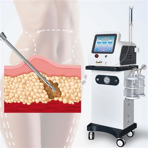Liposuction Devices For Body Contouring And Fat Reduction Business