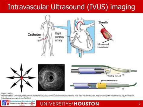 Ppt Learning Based Image Segmentation For Ivus Images Powerpoint