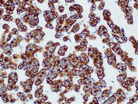 Micoscope Camera Lanoptik Technologies Micoscope Camera Lanoptik Technologies