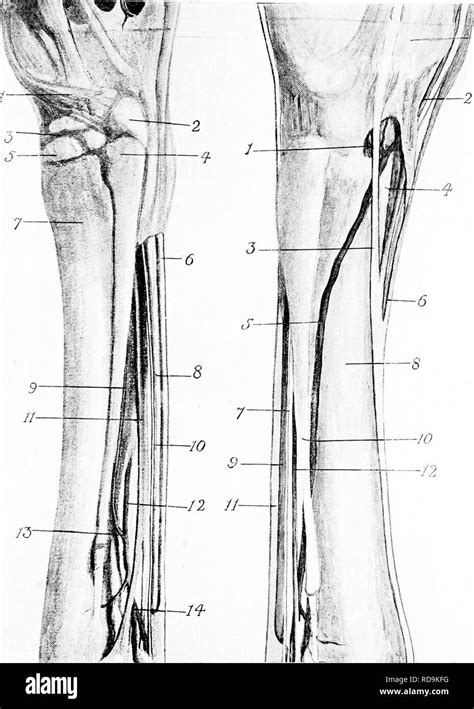 Die Chirurgische Anatomie Des Pferdes Pferde Platte Xxviii