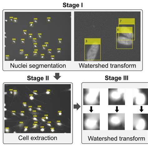 Flowchart Of The Pre Processing Stage Based On Watershed Transform Download Scientific Diagram
