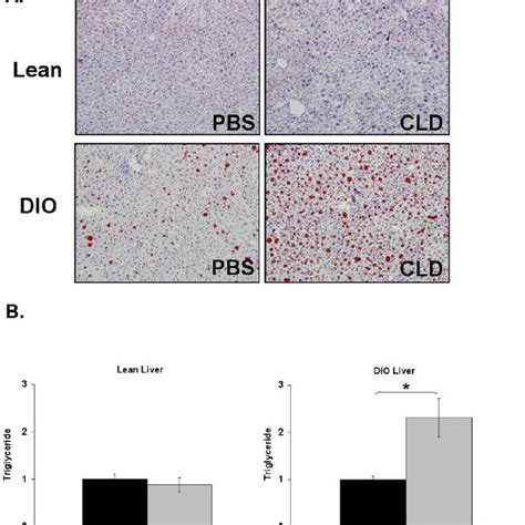Kupffer Cell Ablation In Dio Mice Is Associated With Altered Hepatic