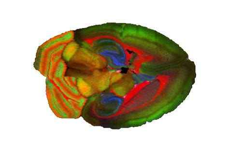 Mass Spectrometry Imaging Desi And Maldi Waters