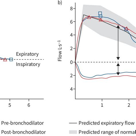 A Spirometry Demonstrating Normal Inspiratory And Expiratory Download Scientific Diagram