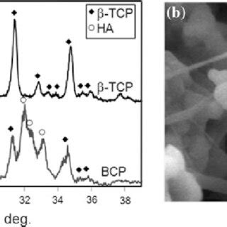 A XRD Pattern Of The Synthesized B TCP And BCP Powders B SEM Download Scientific Diagram