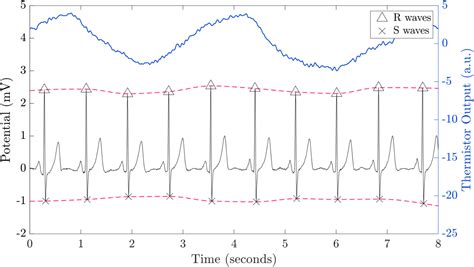 Figure 1 From Unsupervised Ensembling Of Multiple Software Sensors With
