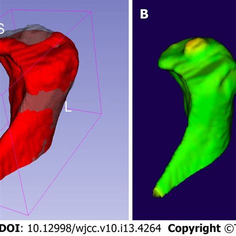 Three Dimensional Reconstruction Of Cone Beam Computed Tomography