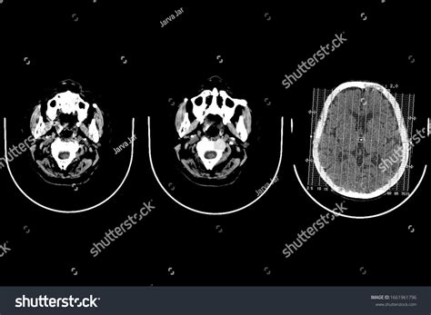 Image Show Ct Brain Anatomy Stock Photo Shutterstock