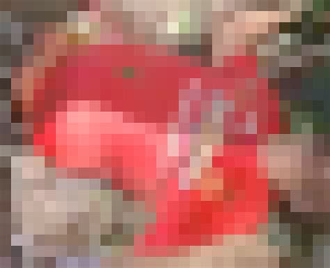 【閲覧注意】人間って体が ”こうなっても” まだ意識はあるんだな（動画あり） ポッカキットポッカキット