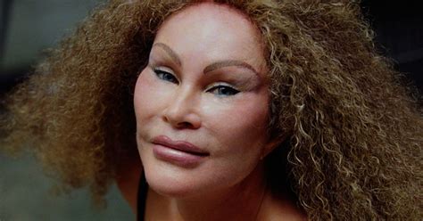 Catwoman Socialite Jocelyn Wildenstein Known For Major Plastic