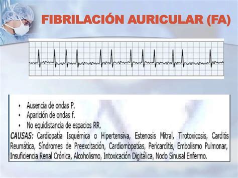 Arritmias Cardiacas Y Ritmos De Paro 2022pptx