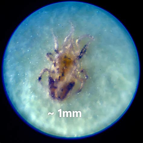 Help Us Identifying This Tiny Bug Rbugidentification