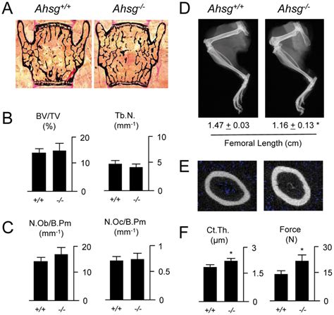 Normal Trabecular Bone Mass But Increased Cortical Bone Strength In Download Scientific