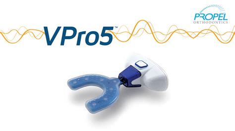 Shorten Orthodontic Treatment with VPro5 in Bonita Springs - SMILE Dental