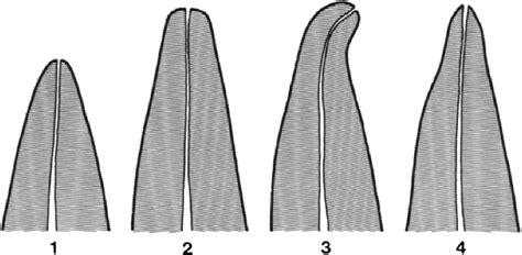 Deviating Root Forms [ After Levander And Malmgren 1988 ] 1 Short Download Scientific