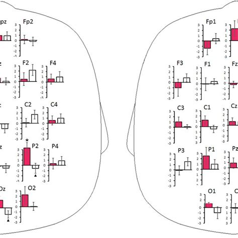 Reactivity indices of the EEG α rhythm in children with left side A Download Scientific