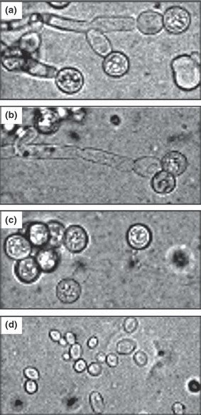 Pseudomycelial Growth And Chlamydospore Production By C Dubliniensis Download Scientific