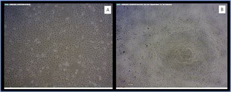 A Mcf 7 Breast Cancer Cell And B Mcf 10a Breast Cell Under Download Scientific Diagram