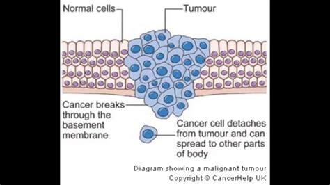 Malignant Cells Diagram