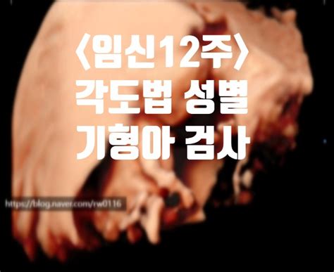 출산일기 1차 기형아 검사각도법 성별 확인 네이버 블로그
