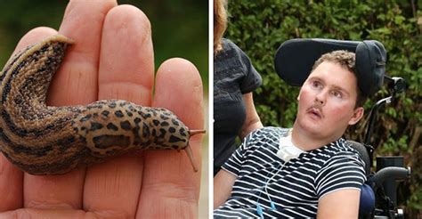 After Swallowing A Slug As Dare Former Rugby Player Left Paralyzed For