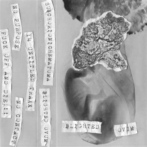 Subchorionic Hematoma Blighted Ovum Subchorionic Hematoma Carnal Tumor