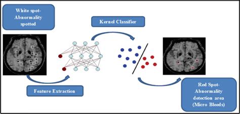 Cpp Ocnn Cerebral Micro Bleeds Image For Abnormality Detection Download Scientific Diagram
