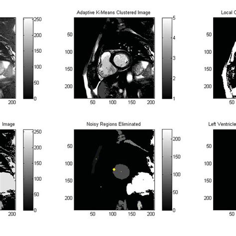 Fast Fully Automatic Left Ventricle Segmentation For Sample Mri Frame 6