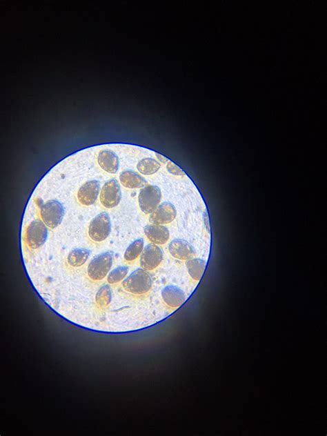 Dinoflagellate Microscope ID Identification Forum Nano Reef Community