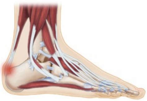 Practice Quiz Lower Leg Ankle Foot Flashcards Quizlet