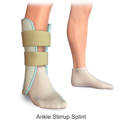Ankle Splints Definition Types Uses Study Com