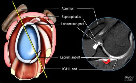 Shoulder Labrum Anatomy