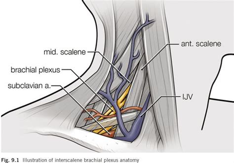 Ultrasoundguided Interscalene Brachial Plexus Block Youtube