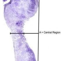 Calculation Of Arch Index Fig 4 Calculation Of Arch Index Download Scientific Diagram