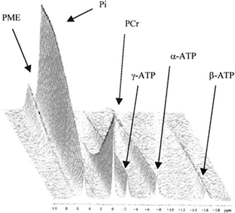 Nmr Based Meat Analysis Creative Biostructure