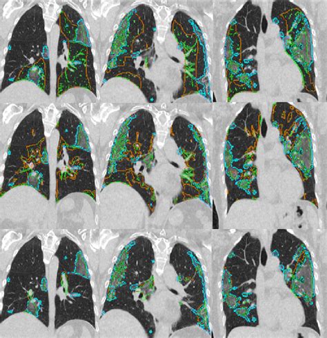 post processed segmentation results of cam 1st row dcam 2nd row