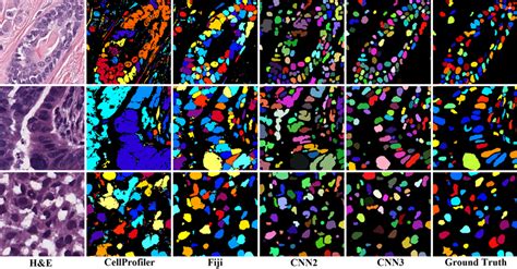 Deep Learning In Digital Pathology A Simple Introduction By Marco Maggiotti Medium